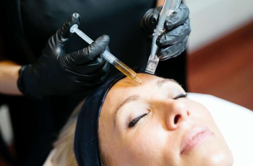 Meso-Needling – Artemis Medispa